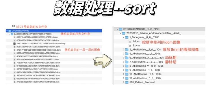 数据预处理- sort 乱序DICOM 文件 - 知乎