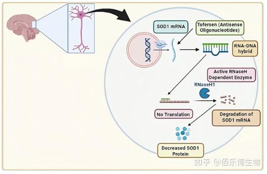 震撼！全球首款渐冻症基因疗法Tofersen精准靶向SOD1蛋白，国内重磅获批！ - 知乎