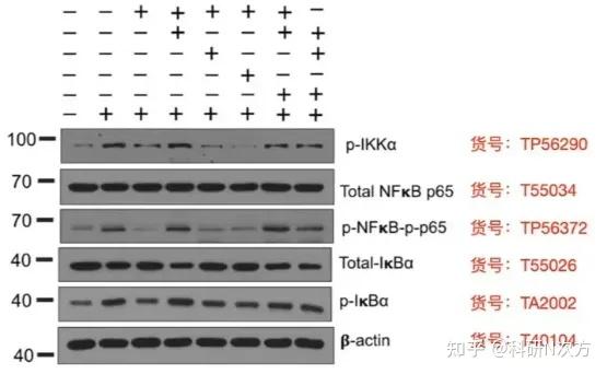 科研干货 | 手把手教你跑出好看的wb实验结果图 - 知乎