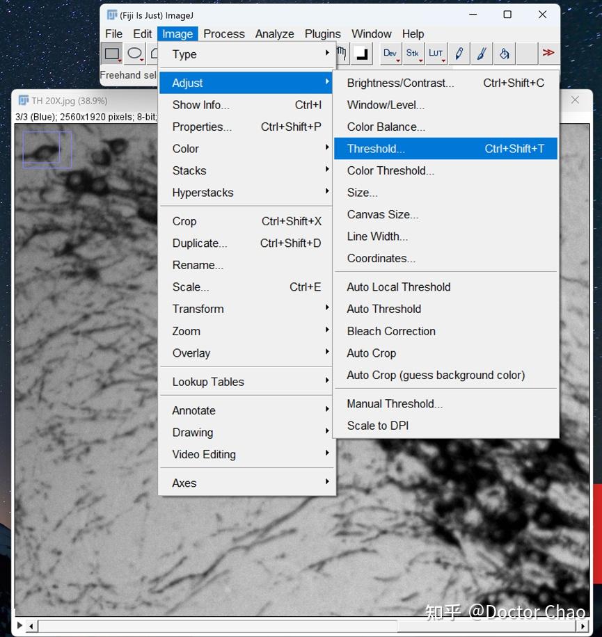 用imagej 免疫组化及荧光强度的分析？ - 知乎