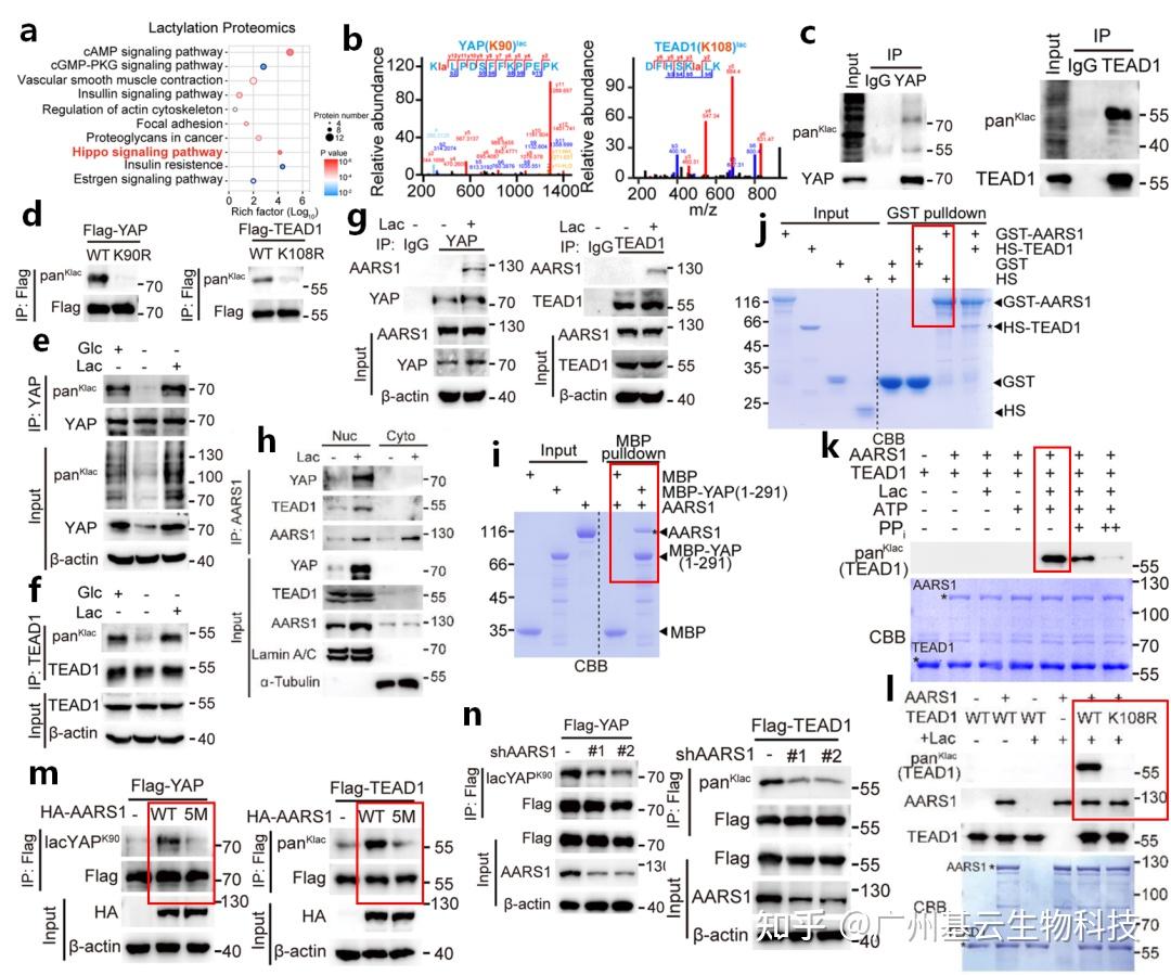 《JCI》解读：肿瘤乳酸化修饰与泛素化修饰对抗！丙烯酰tRNA合成酶AARS1乳酸化修饰YAP复合体促进信号传导 - 知乎