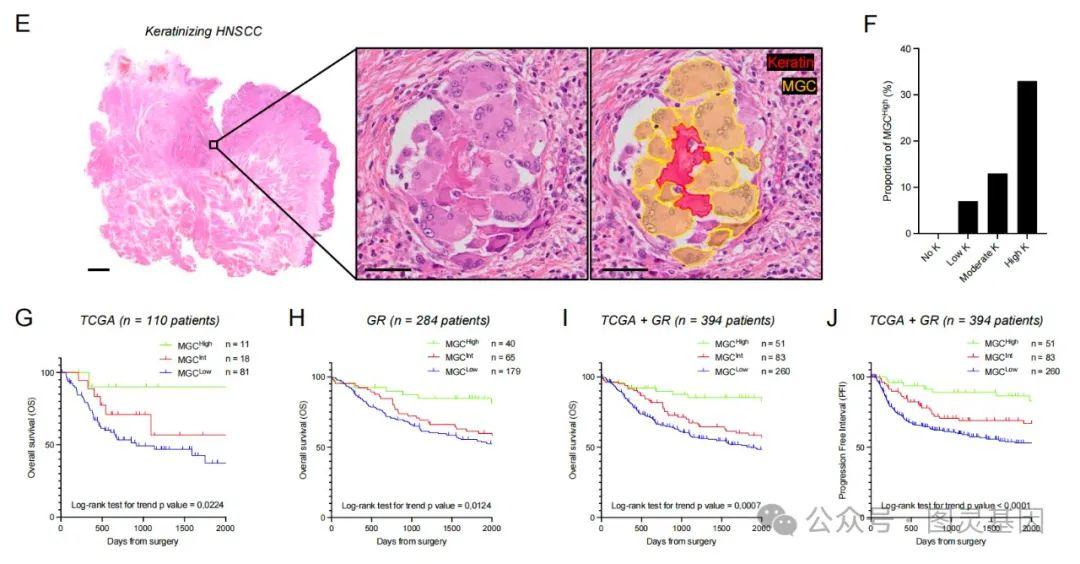 Cancer Discov | 解码高密度多核巨细胞抗癌原理 - 知乎