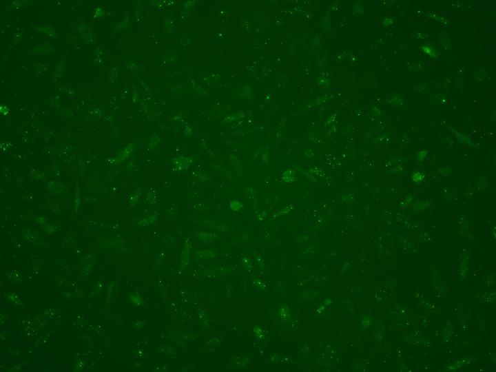 性能媲美RNAiMAX与lipo3000的Rfect V2 siRNA转染试剂 - 知乎