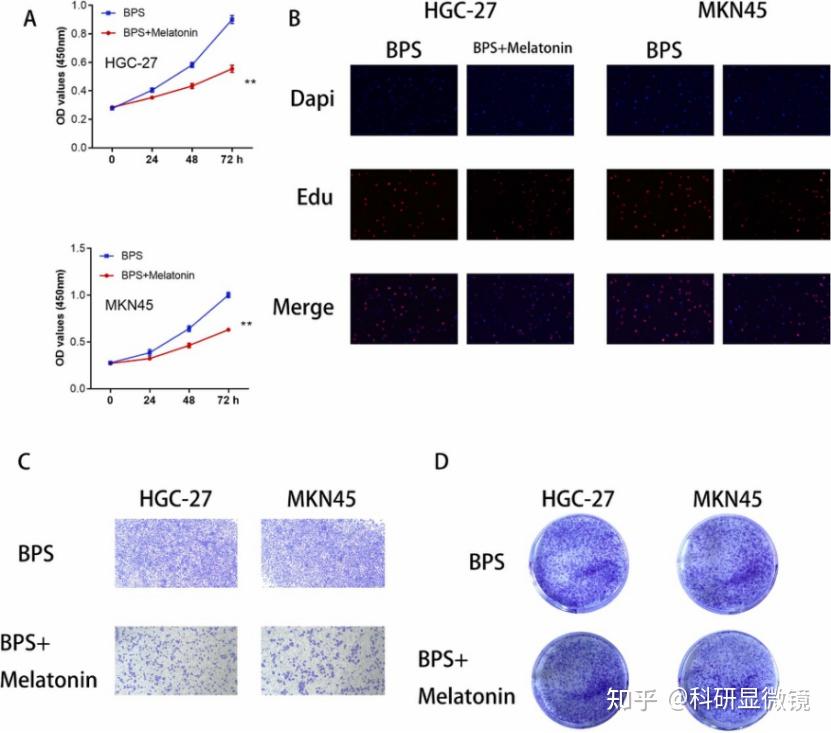 LTSM模型预测数据如何归一化? - 知乎