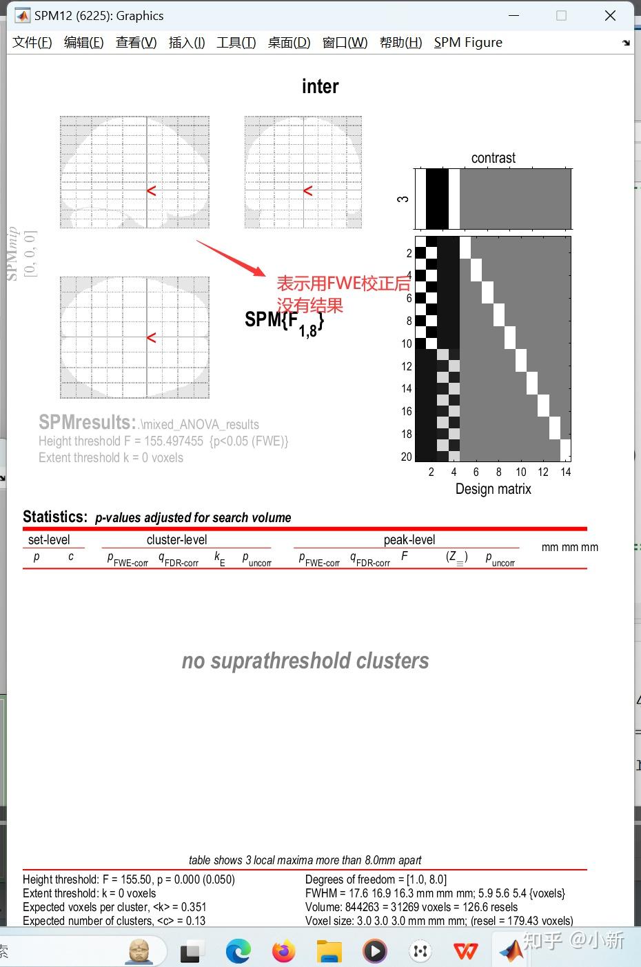 14（1）-SPM-fmri任务态二阶分析:多重比较校正FWE&FDR - 知乎