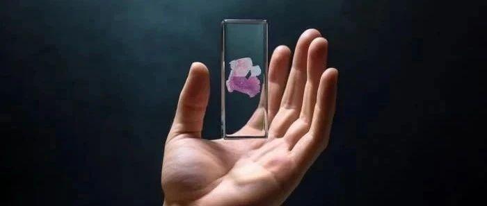 Nat Commun | 俞章盛/张岳团队开发基于组织病理学图像的癌症诊断和生存预测AI基础模型 - 知乎