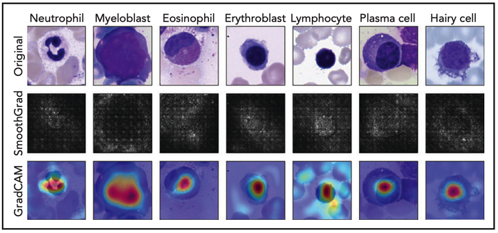 Bone Marrow Cytomorphology 骨髓细胞形态学分类数据集介绍 - 知乎