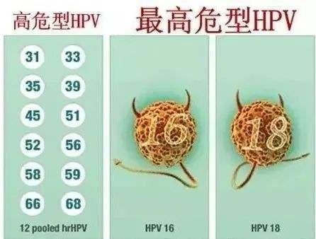 hpv16/18阳性是怎么引起的 - 知乎