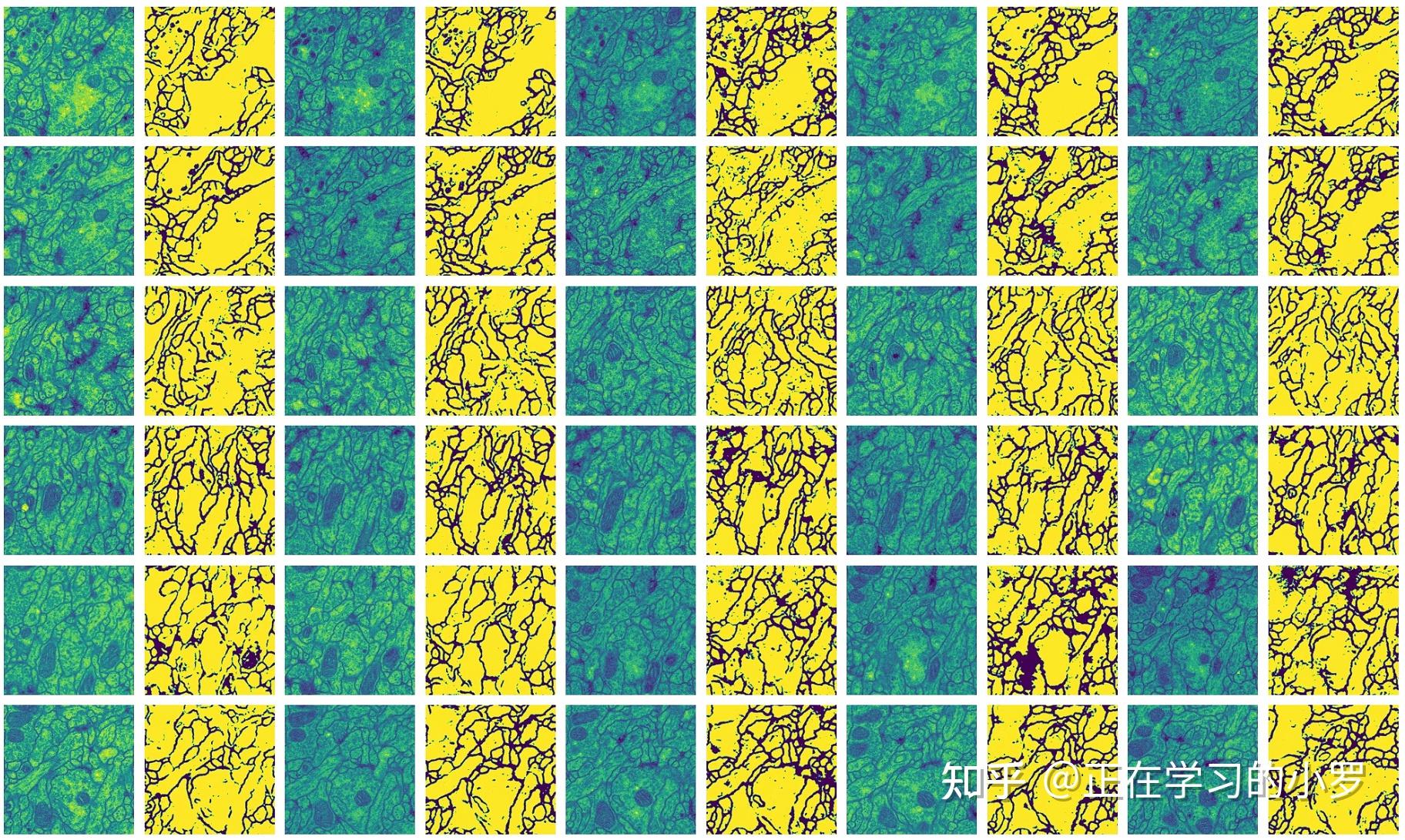 U-Net代码解读python[每周一篇]Week1-U-Net - 知乎