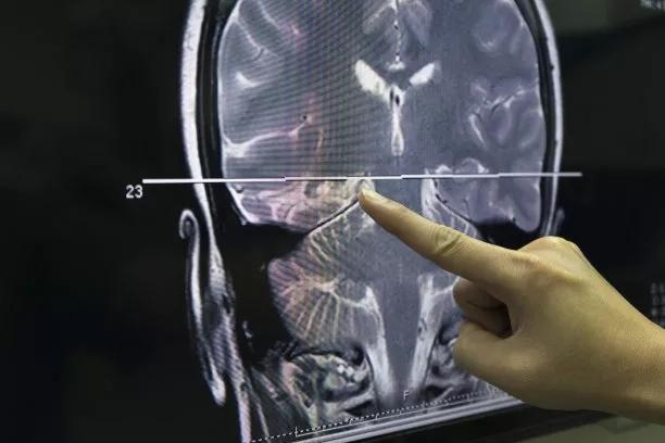 SCI期刊推荐:BRAIN IMAGING AND BEHAVIOR - 知乎