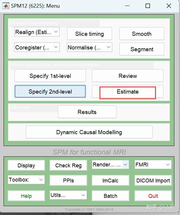 8-SPM-fmri任务态 二阶分析： 单样本t检验 - 知乎