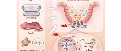 CDD丨ROS 诱导的 DNA 损伤引发的 parthanatos 参与了坏死性小肠结肠炎期间的肠上皮损伤 - 知乎