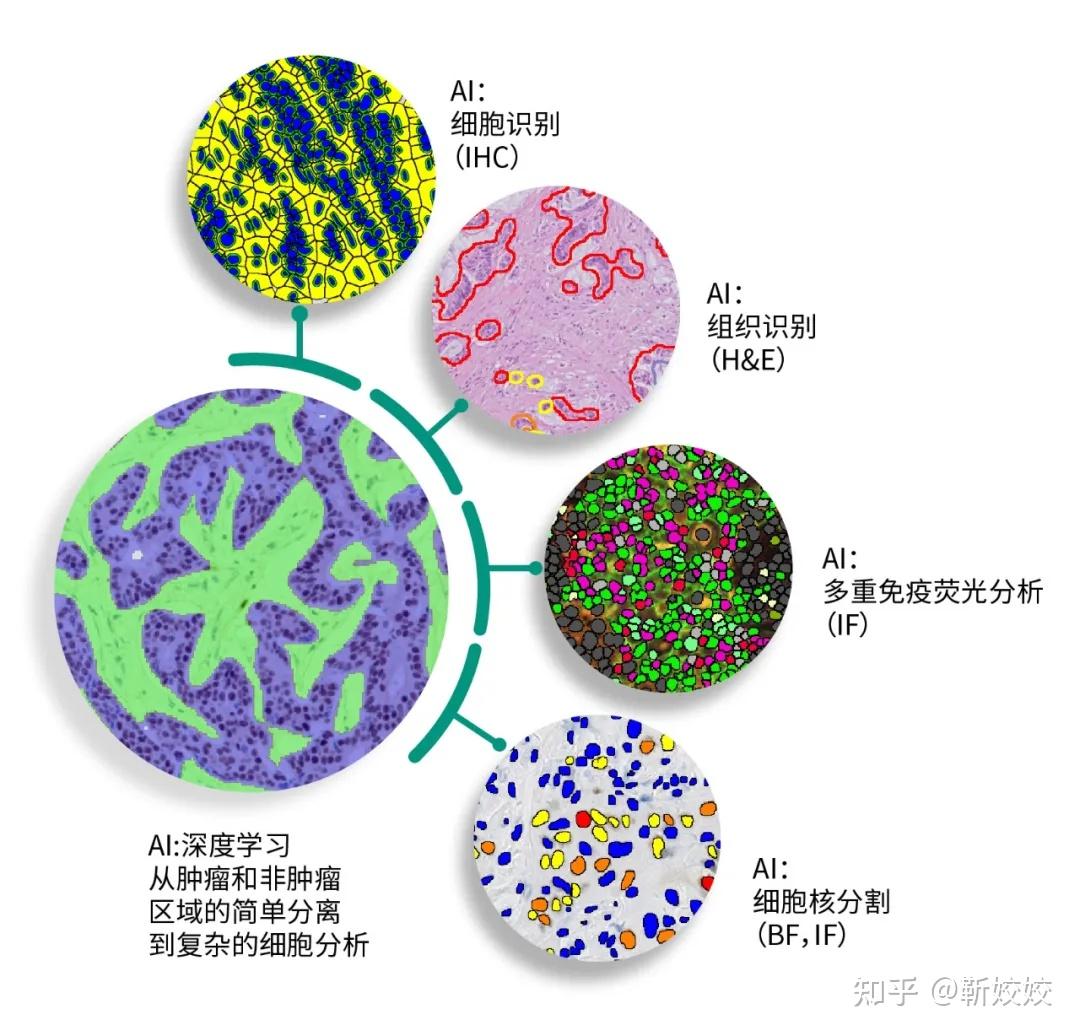 解锁精准医学新纪元：Visiopharm病理分析系统的革命性力量 - 知乎