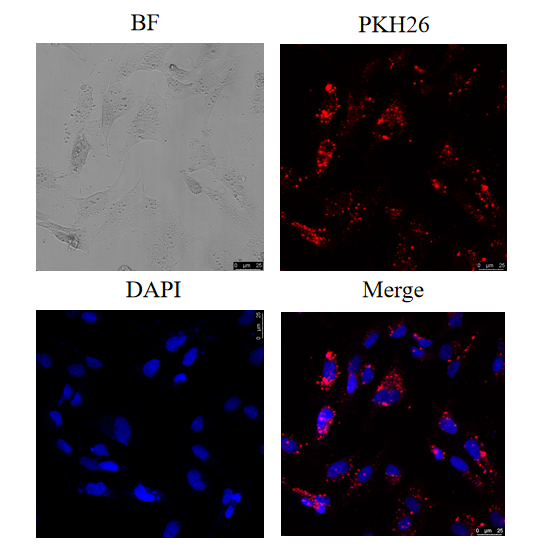 PKH26细胞膜红色荧光探针 - 知乎