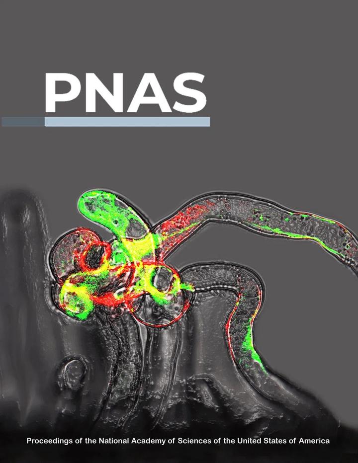 PNAS | 中科院分子植物卓越中心Jeremy Murray组揭示极光激酶AURORA调控豆科植物侵染线形成的分子机制 - 知乎