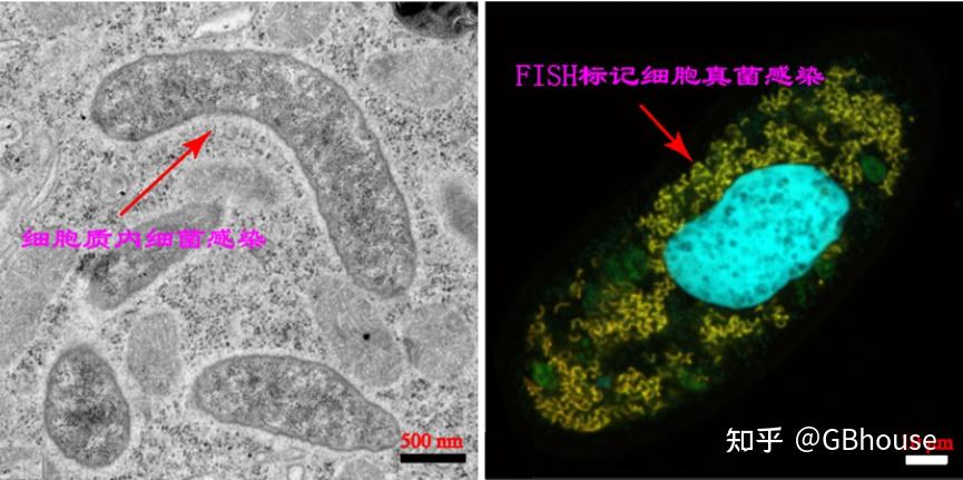 原位杂交四部曲之- 荧光原位杂交技术(fluorescence in situ hybridiza-tion, FISH) - 知乎