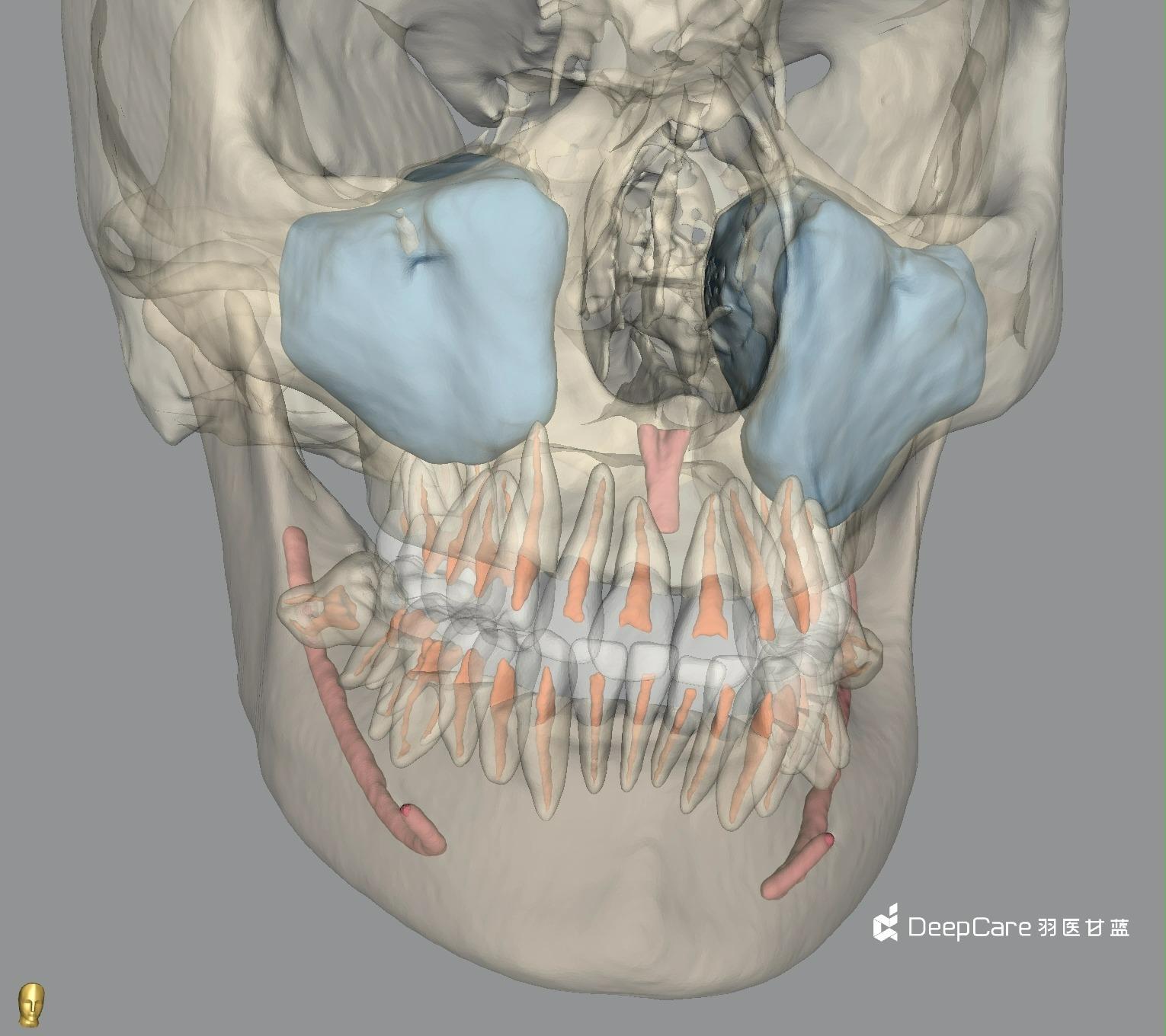 DeepCare羽医甘蓝CBCT最新AI功能登陆IDS 2025，全球开放试用！ - 知乎