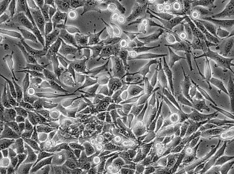 PANC-1细胞购买技巧 - 知乎