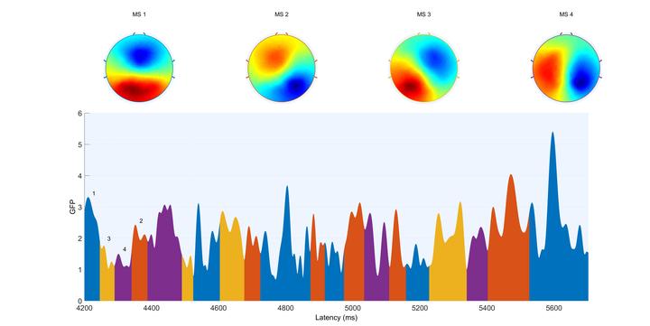 【EEG微状态分析】学习笔记——操作指南 - 知乎