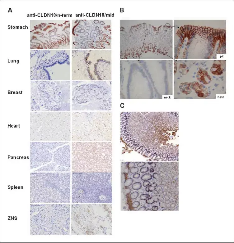 CLDN18.2丨肿瘤免疫治疗赛道的黑马 - 知乎
