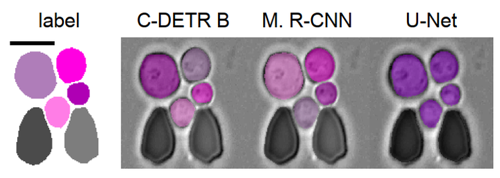 Cell-DETR：基于Transformer的细胞实例分割网络 - 知乎