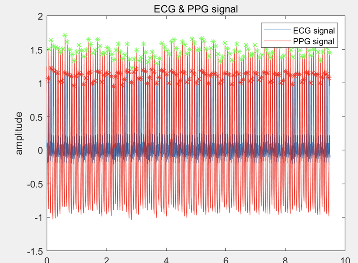 ECG和PPG信号用于PTT、HRV和PRV研究（Matlab代码实现） - 知乎