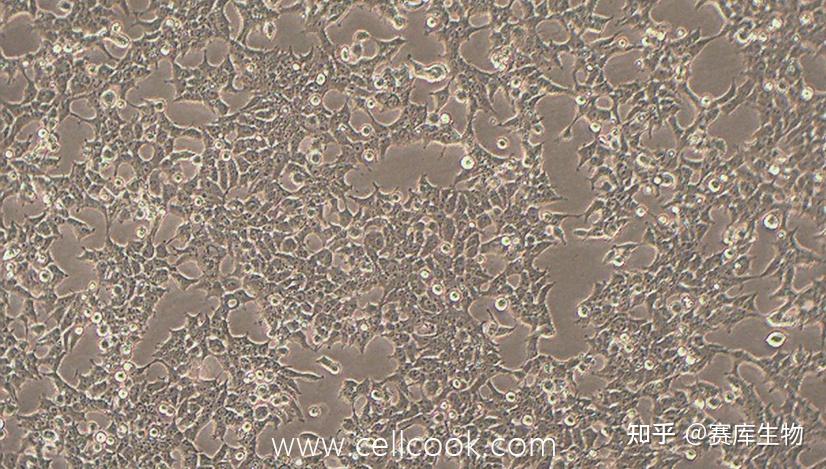 293T细胞到底该怎么养啊！? - 知乎