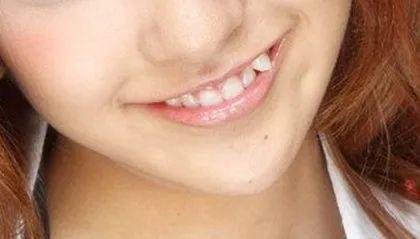 32颗恒牙中，唯独这颗牙，长得再丑再歪也不能拔！ - 知乎