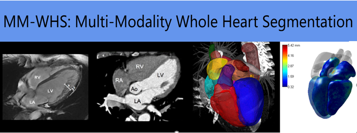 MM-WHS 数据集介绍 - 知乎