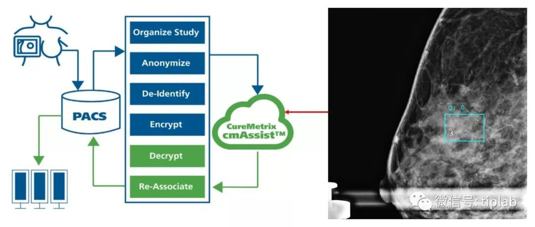 人工智能（AI）技术专利研究系列：CureMetrix，医学影像分析领域的新秀 - 知乎
