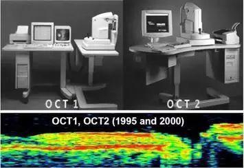 医疗器械技术解析- 什么是OCT - 知乎