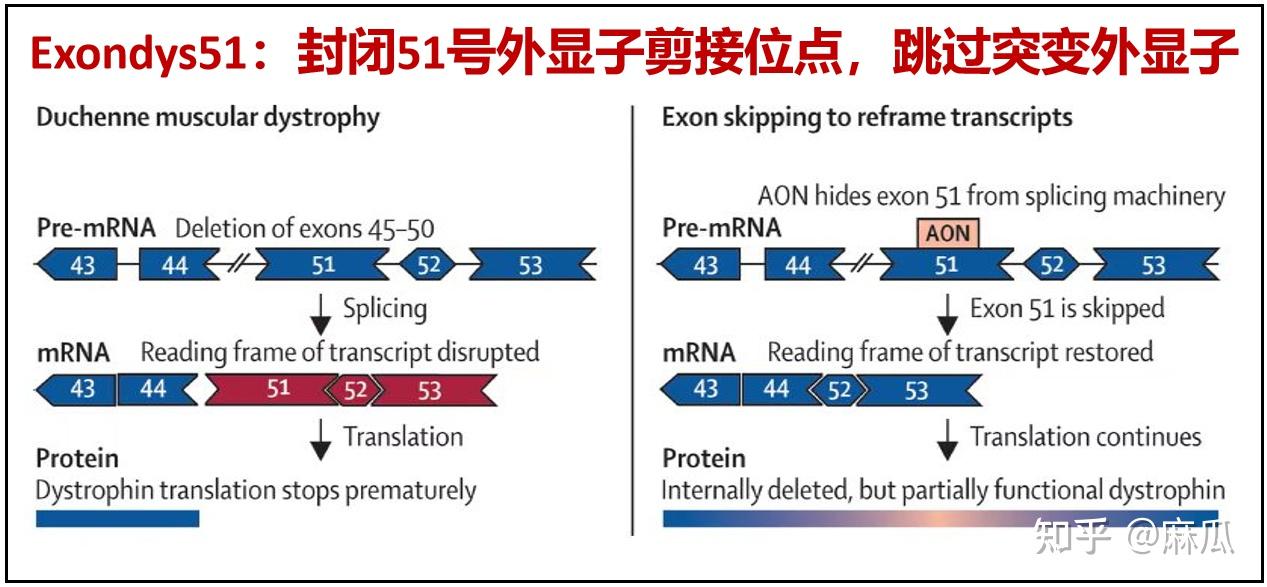 FDA 委员会以微弱优势支持 DMD 基因疗法加速获批，为什么会出现分歧？获批将带来哪些希望和风险？ - 知乎