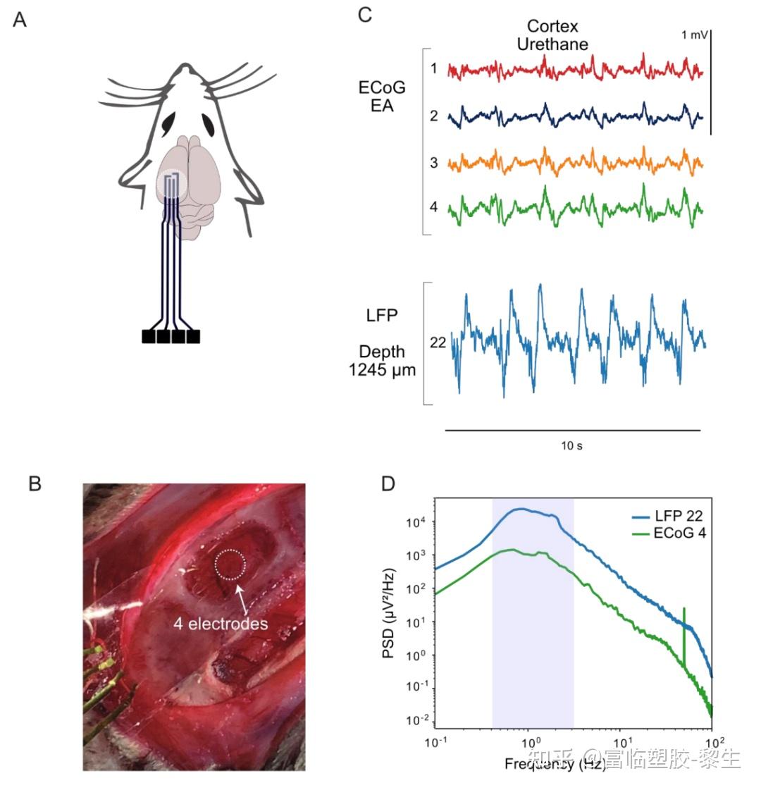 Open Ephys采集板基于银纳米线网络的用于神经记录的透明且柔性的脑皮层电图（ECoG）电极阵列 - 知乎