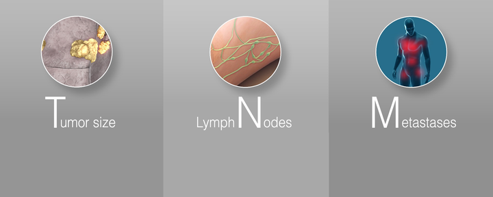 11-08：甲状腺未分化癌（ATC）的TNM分期方法 - 知乎