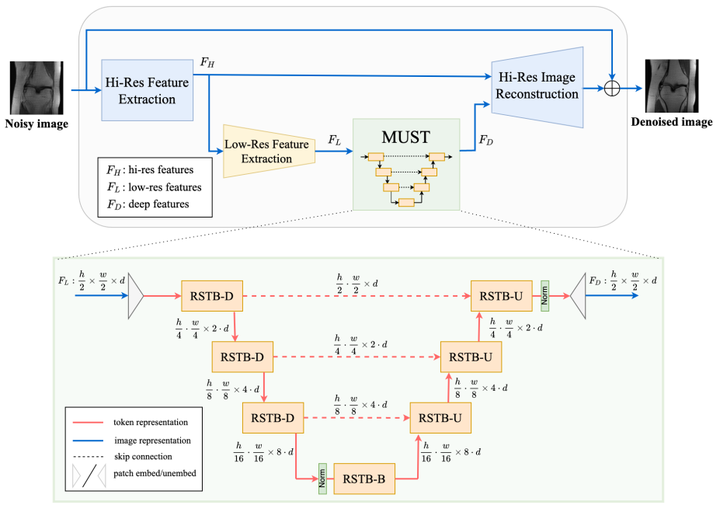 NeurIPS 2022 | HUMUS-Net：用于加速MRI重建的混合展开多尺度网络结构 - 知乎