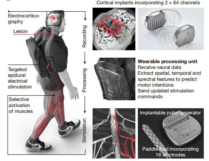 脑机接口之ECoG电极（一） - 知乎