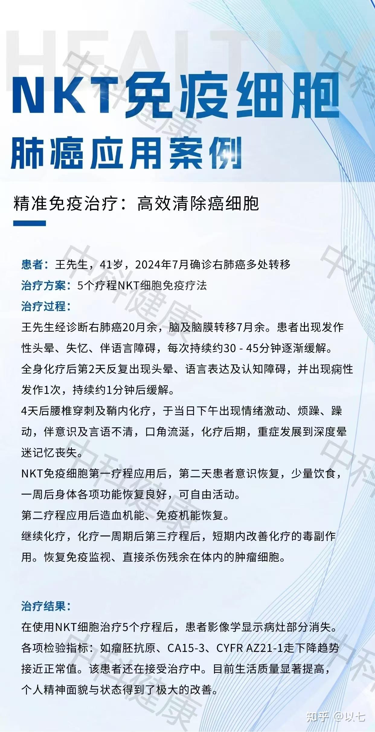 NKT细胞免疫疗法：肿瘤患者的新希望（附应用案例） - 知乎