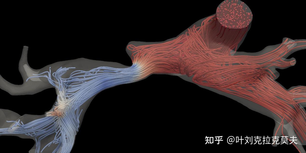 开源科学工程技术软件介绍63 – 血流模拟和分析软件Simvascular - 知乎