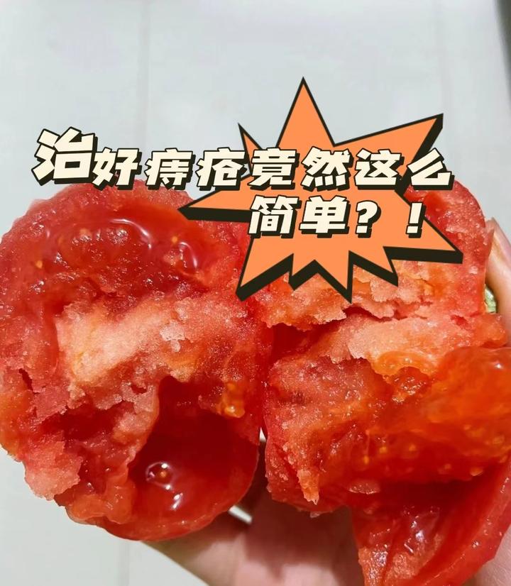 如何1个月轻松除痔？这篇文章一定要阅读完！秘诀原来是这样！ 知乎 4563