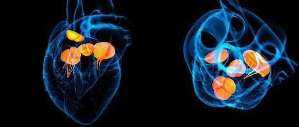 吴永健教授：TAVR领域2022年最新进展 - 知乎