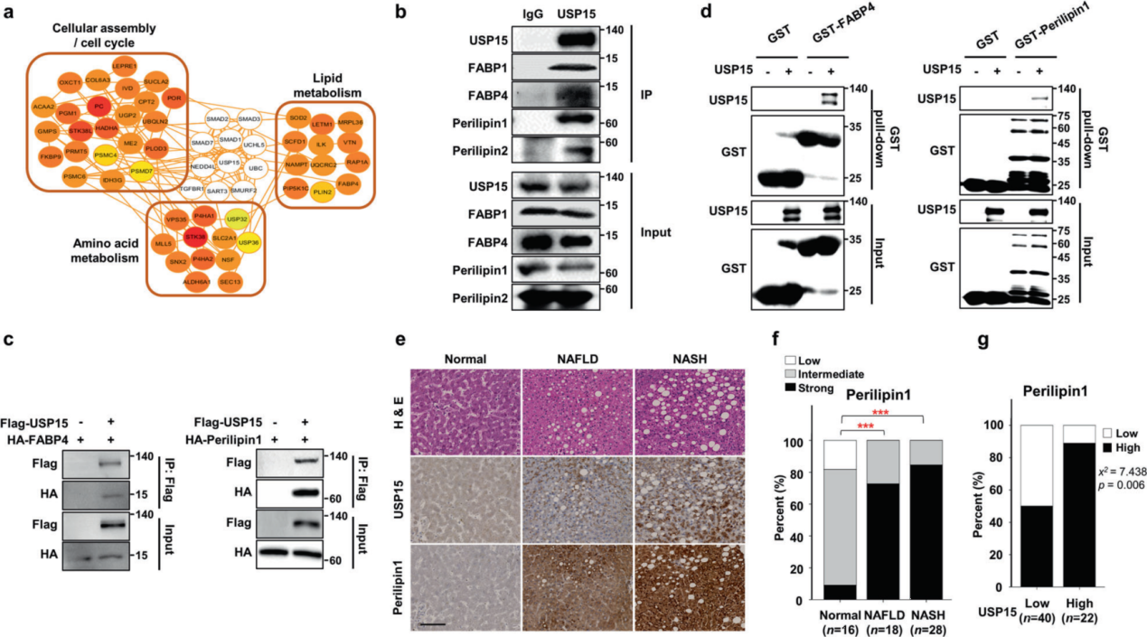消融去泛素酶USP15可改善非酒精性脂肪肝和非酒精性脂肪性肝炎 - 知乎