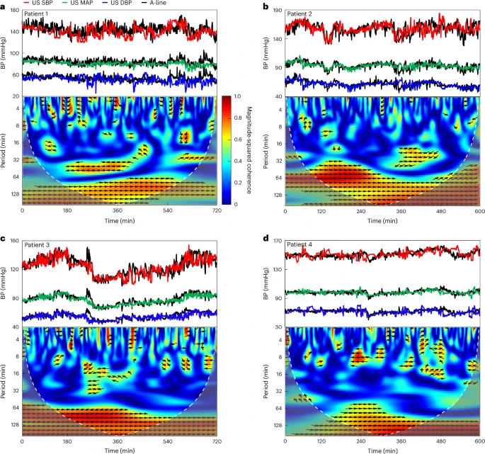 Nature BME | 可穿戴式血压超声传感器临床检测安全性与准确性得到了验证 - 知乎
