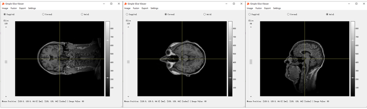 Python科研图像处理——Slice Viewer - 知乎