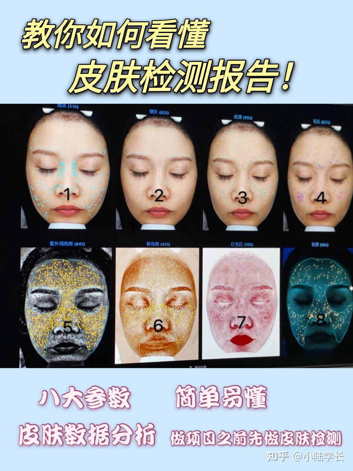 教你如何看懂visa皮肤报告！简单易懂~ - 知乎