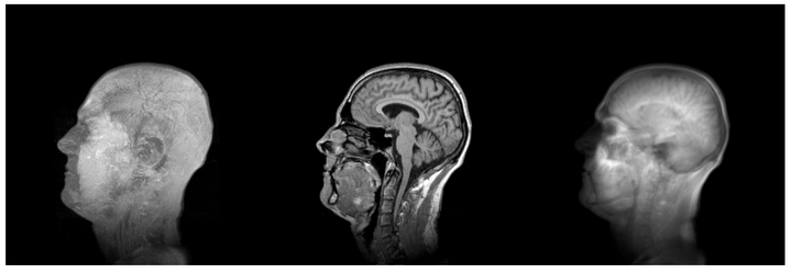 MATLAB科研图像处理——图像堆栈Z projection - 知乎
