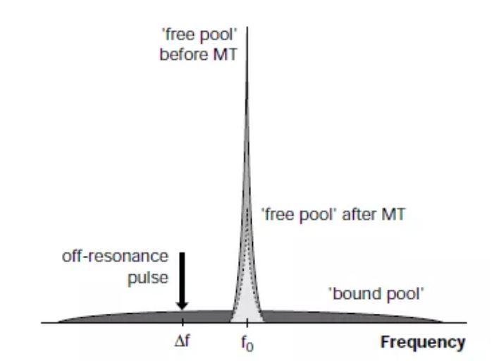 什么叫做磁化传递MTC？ - 知乎