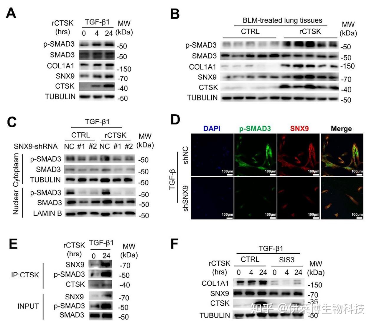 Advanced science最新研究表明： 组织蛋白酶K通过促进成纤维细胞谷氨酰胺代谢和胶原蛋白合成加重肺纤维化 - 知乎