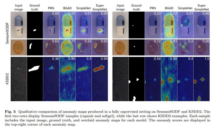 SuperSimpleNet: 不再浪费任何一张标签！首个统一所有监督范式的表面缺陷检测模型 - 知乎
