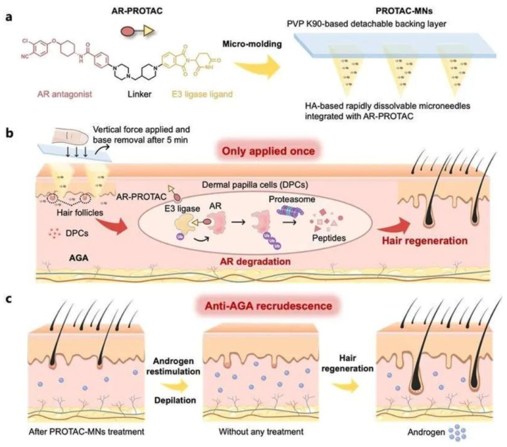 脱发者福音！浙大/海大在新型生发微针贴片用于AGA治疗获进展 - 知乎