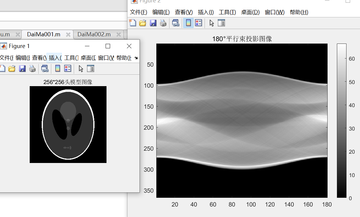 CT断层成像系列02——Shepp-Logan头模型的平行束投影数据仿真(Matlab|C++代码实现) - 知乎